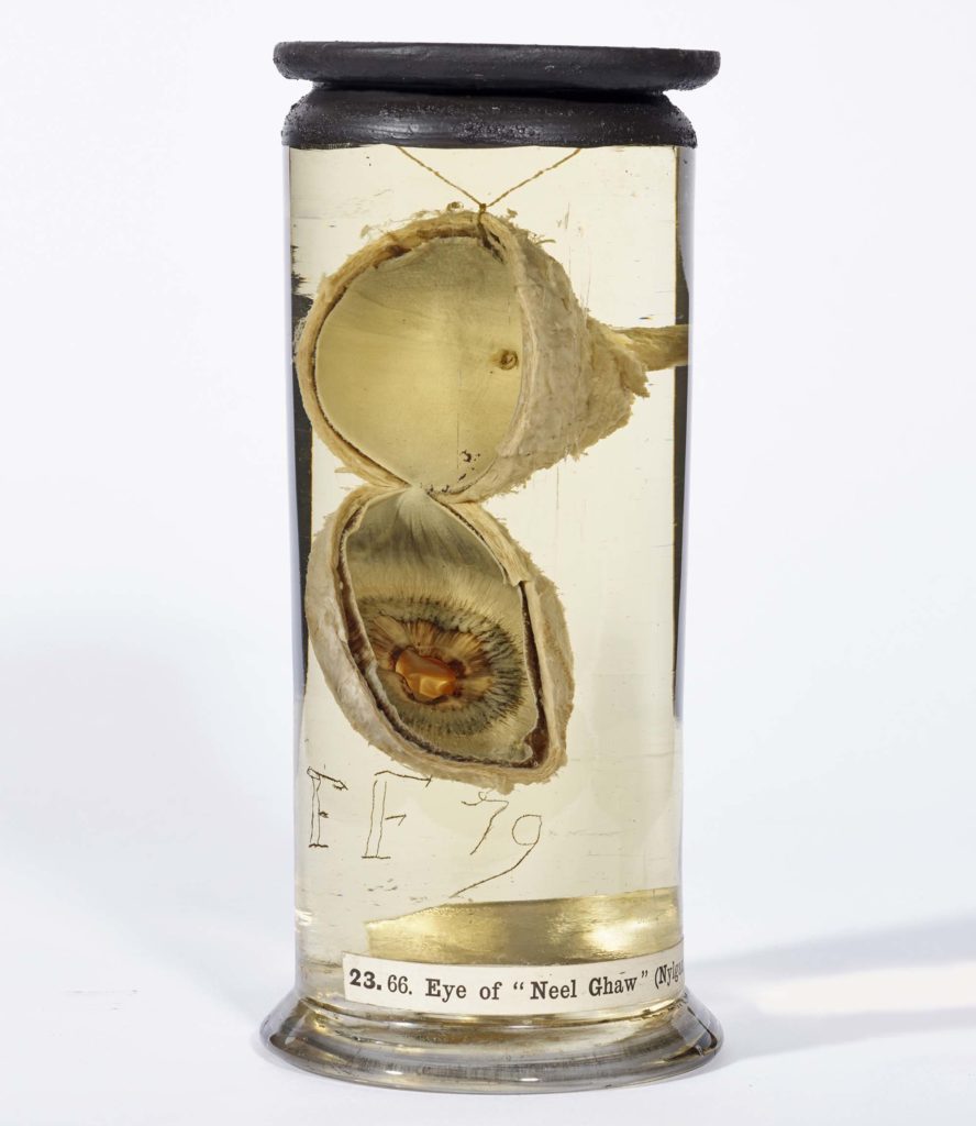 The wondrous objects collected by William Hunter of the Hunterian ...