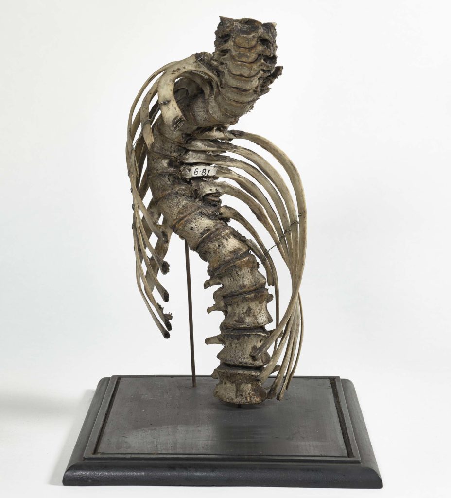 The wondrous objects collected by William Hunter of the Hunterian ...