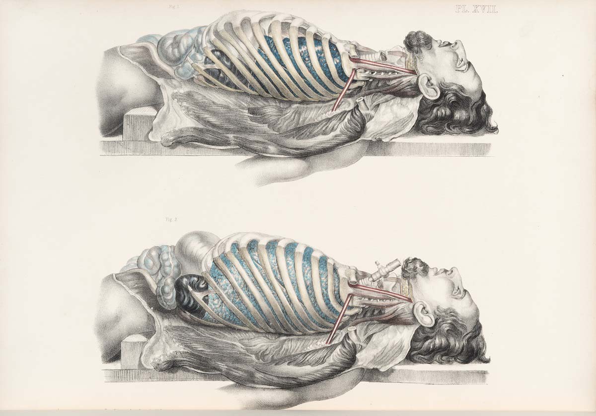 Under the skin – the art of dissection at the Royal College of ...