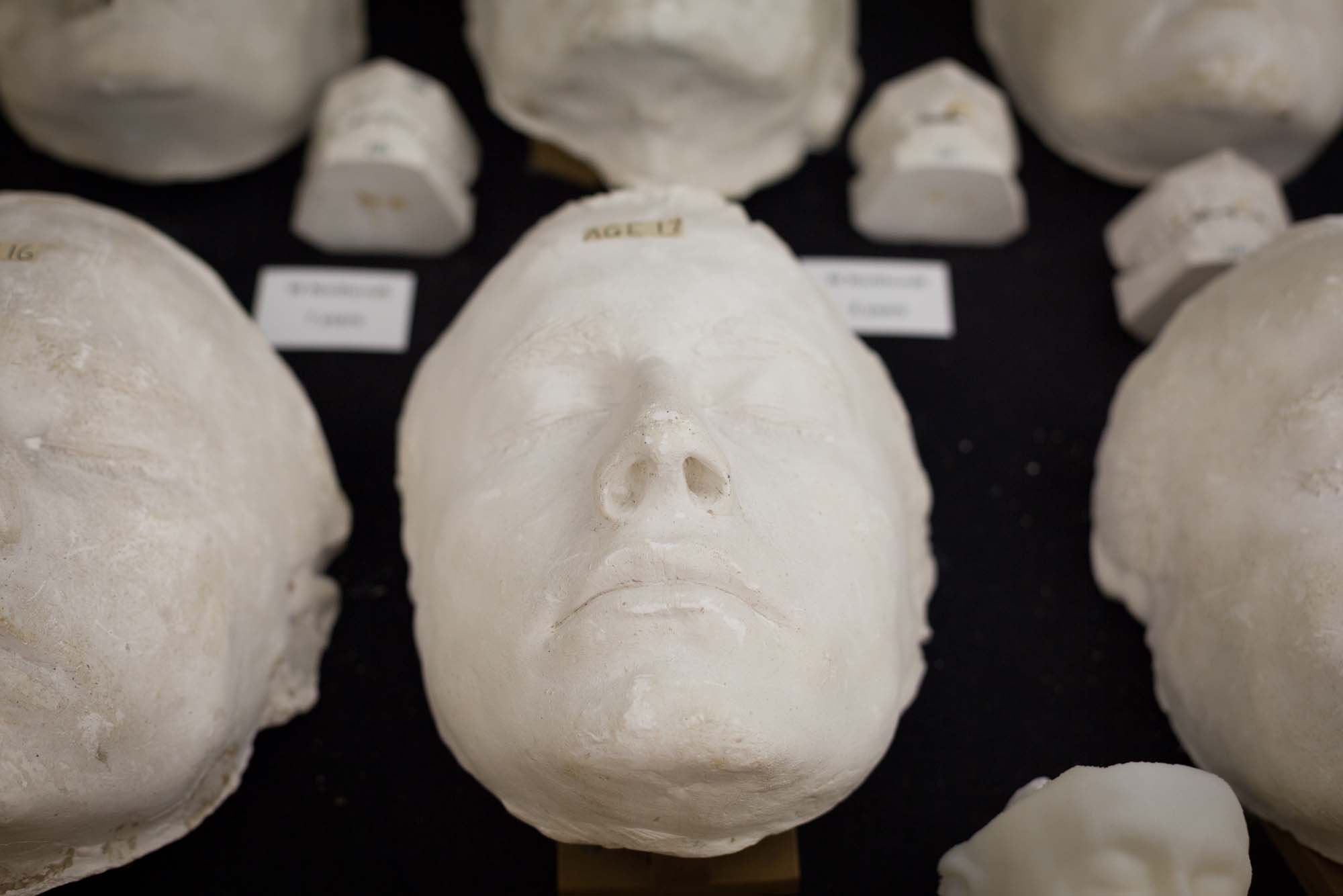 The curious collection of masks made by an orthodontic pioneer – Museum ...